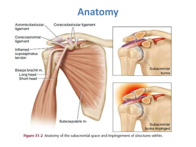 Intra articular injection by dr. ahmed shedeed | PPTX