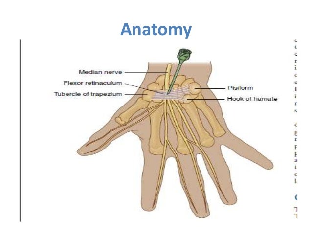 Intraarticular Steroid Injection