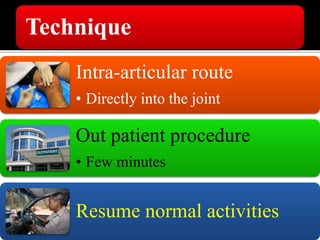 Intraartiular knee injection | PPTX