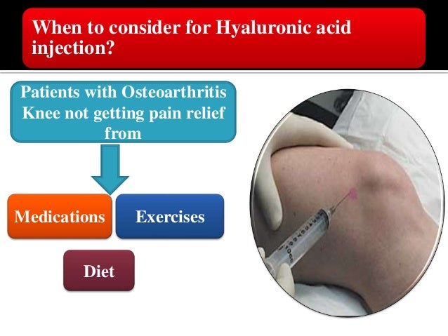 Intraartiular knee injection