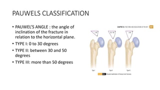 Intracapsular fracture neck of femur | PPTX