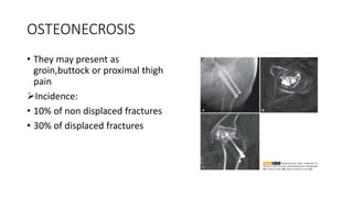 Intracapsular fracture neck of femur | PPTX