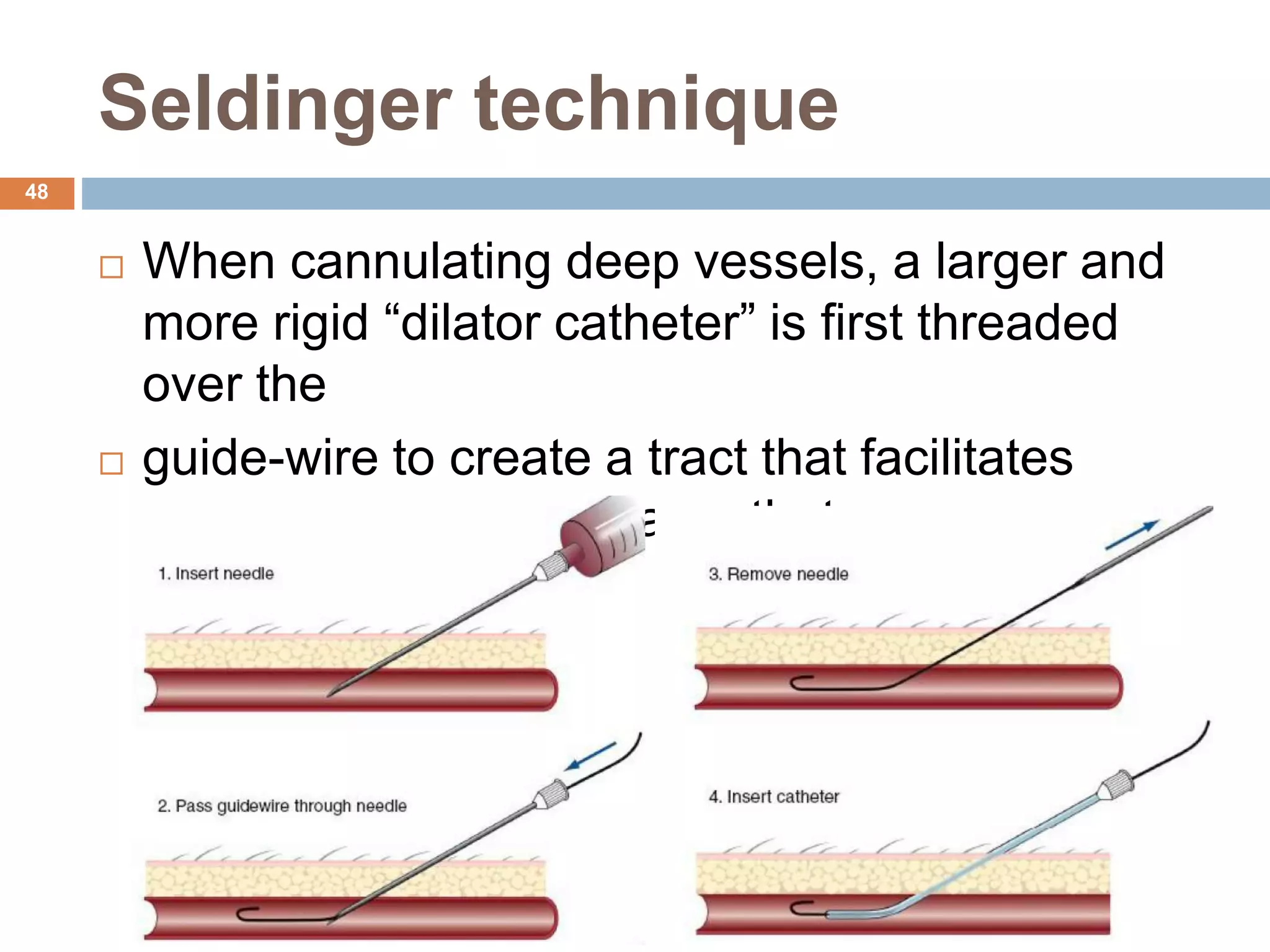 Intracatheters | PPTX