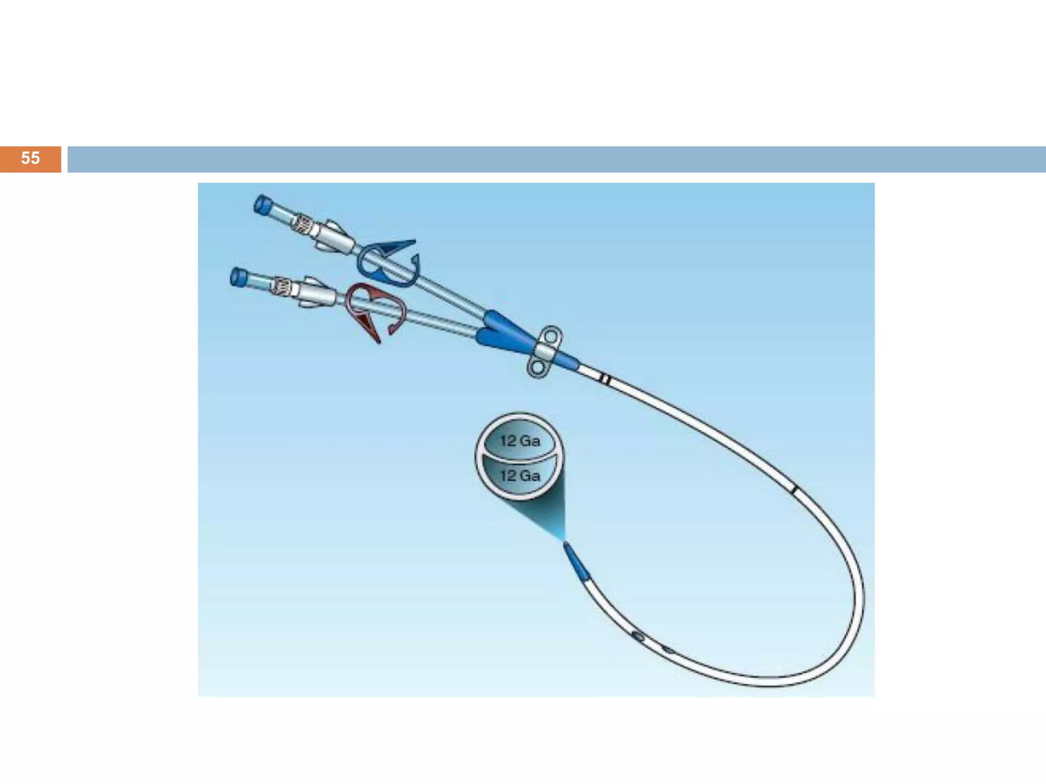 Intracatheters | PPTX