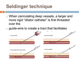 Intracatheters | PPTX