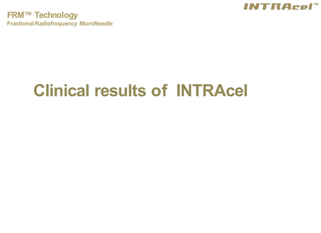 INTRAcel before-and-after collection | PPT