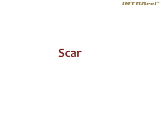 INTRAcel before-and-after collection | PPT
