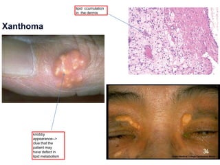 Intracell accumulation final | PPTX