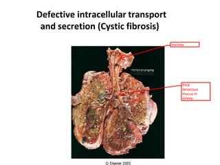 Intracell accumulation final | PPTX