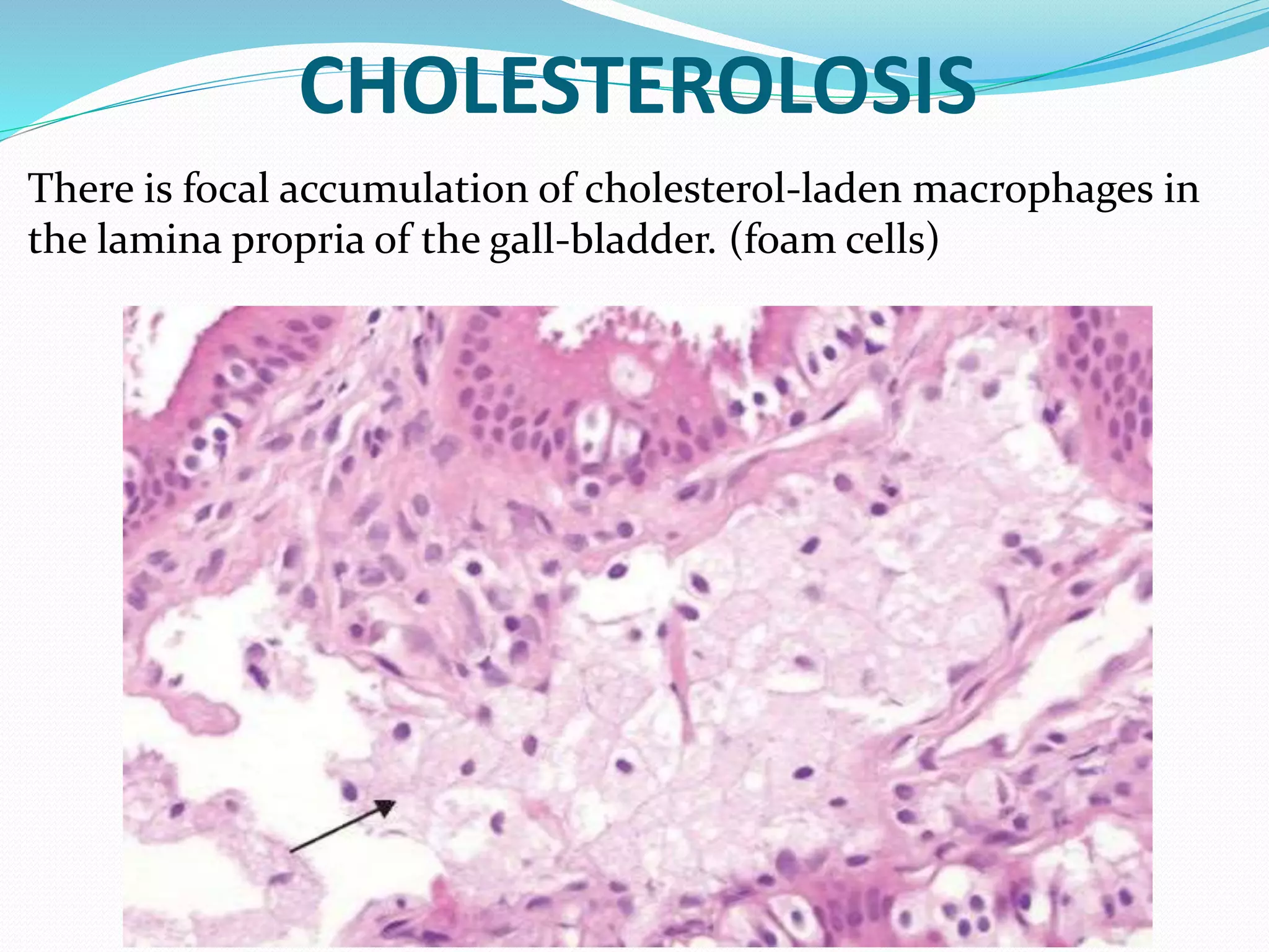 Intracellular accumulations 1 | PPTX