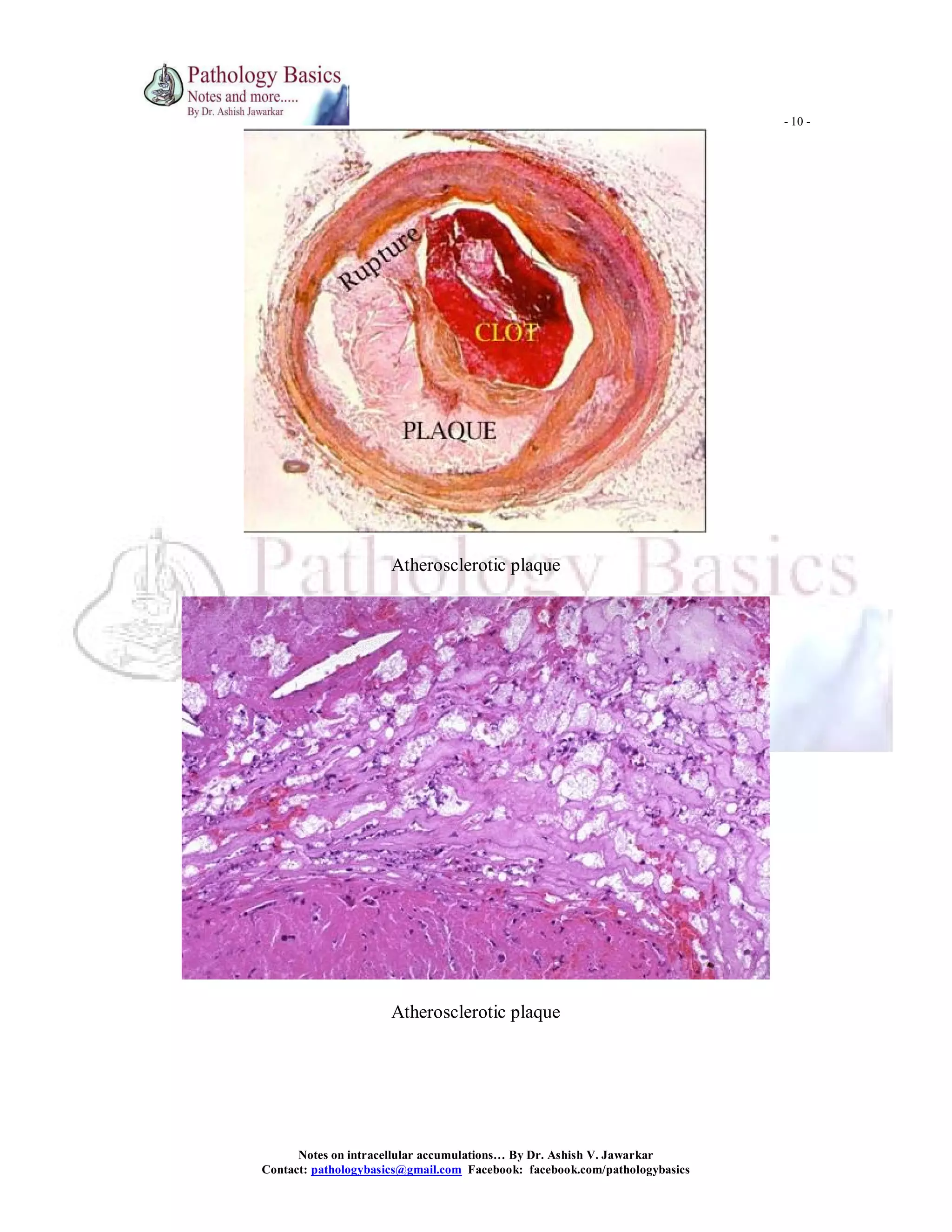 Intracellular accumulations | PDF