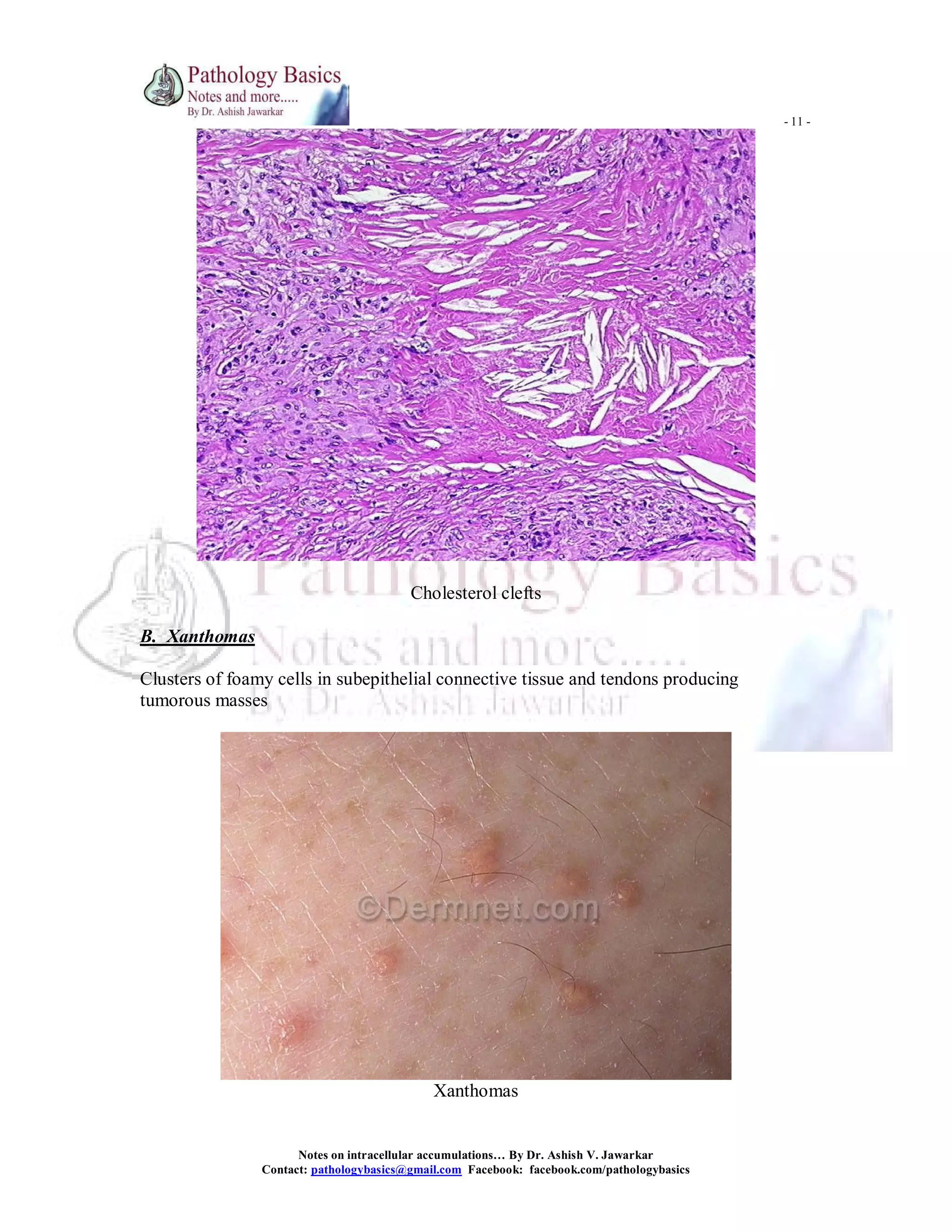 Intracellular accumulations | PDF