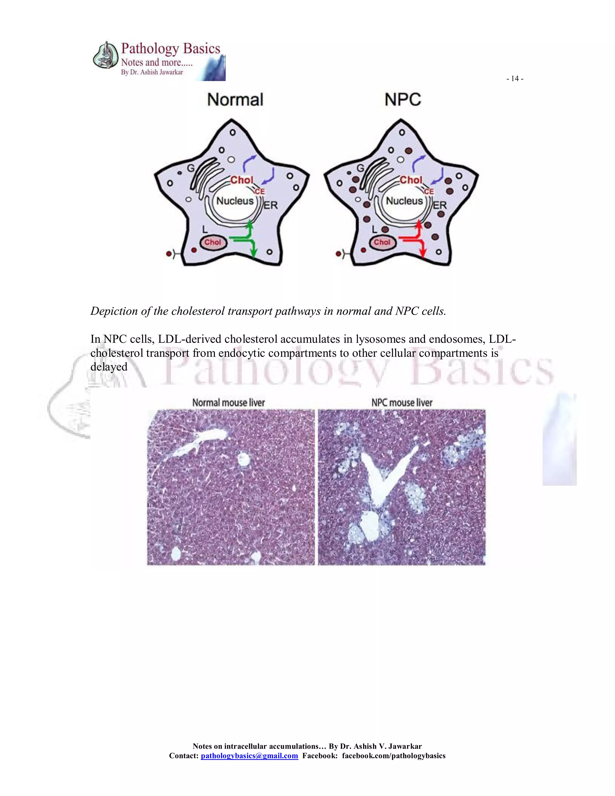 Intracellular accumulations | PDF