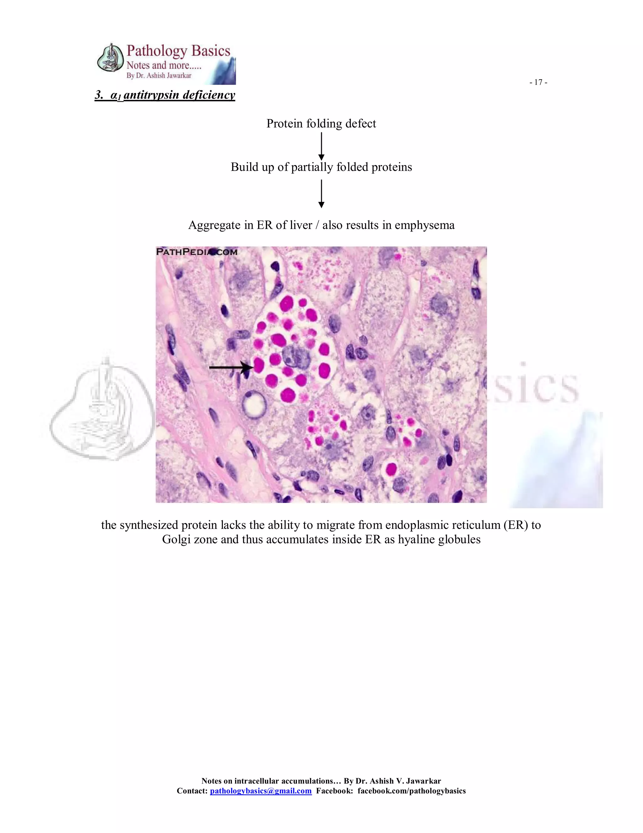Intracellular accumulations | PDF