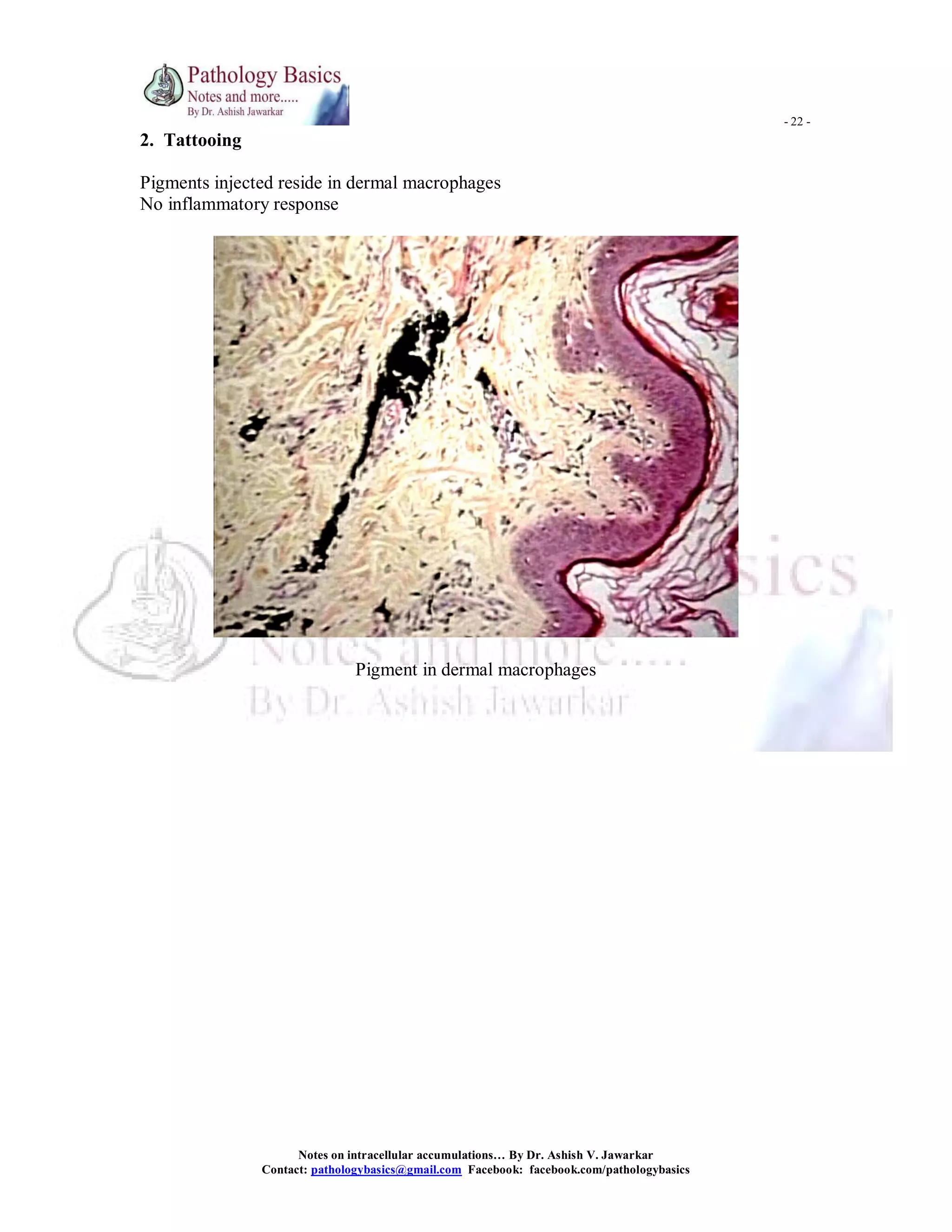 Intracellular accumulations | PDF