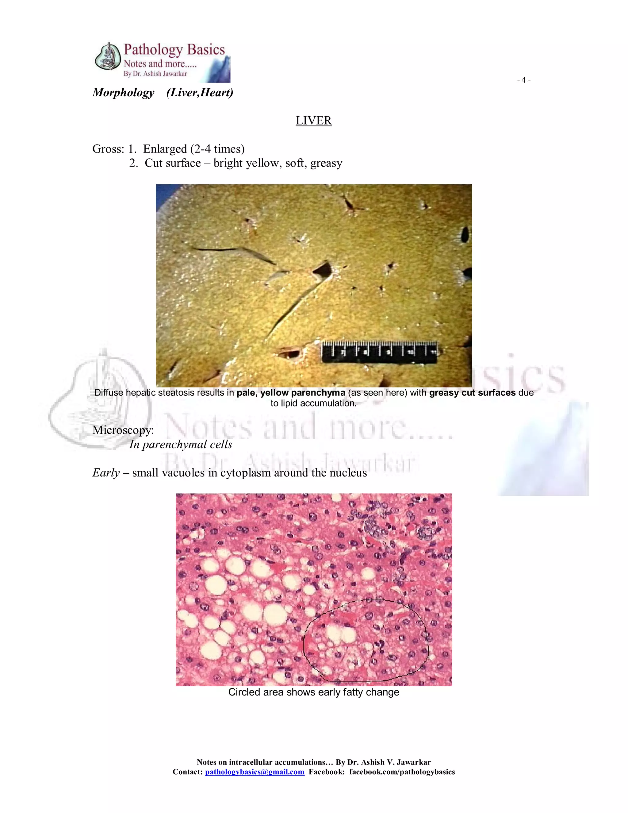 Intracellular accumulations | PDF