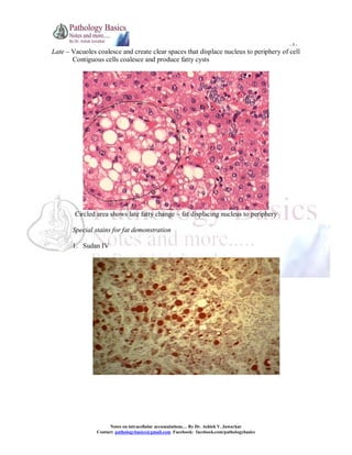 Intracellular accumulations | PDF