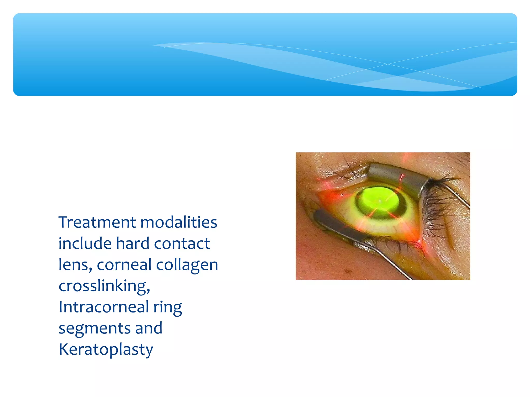 Intracorneal ring-segments-by-femtosecond-tunnel-creation | PPT