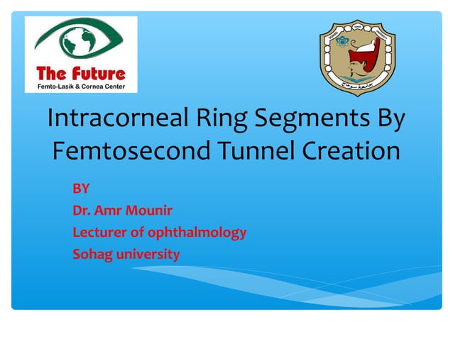 Intracorneal ring-segments-by-femtosecond-tunnel-creation | PPT
