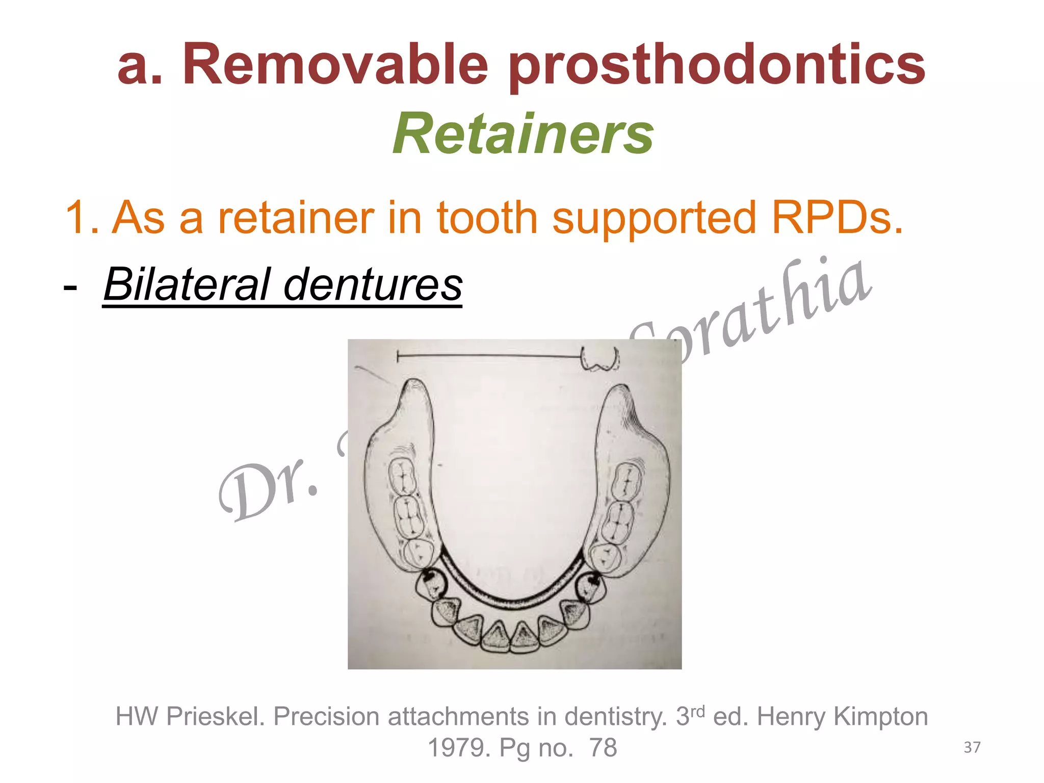 Intracoronal Attachments | PPTX
