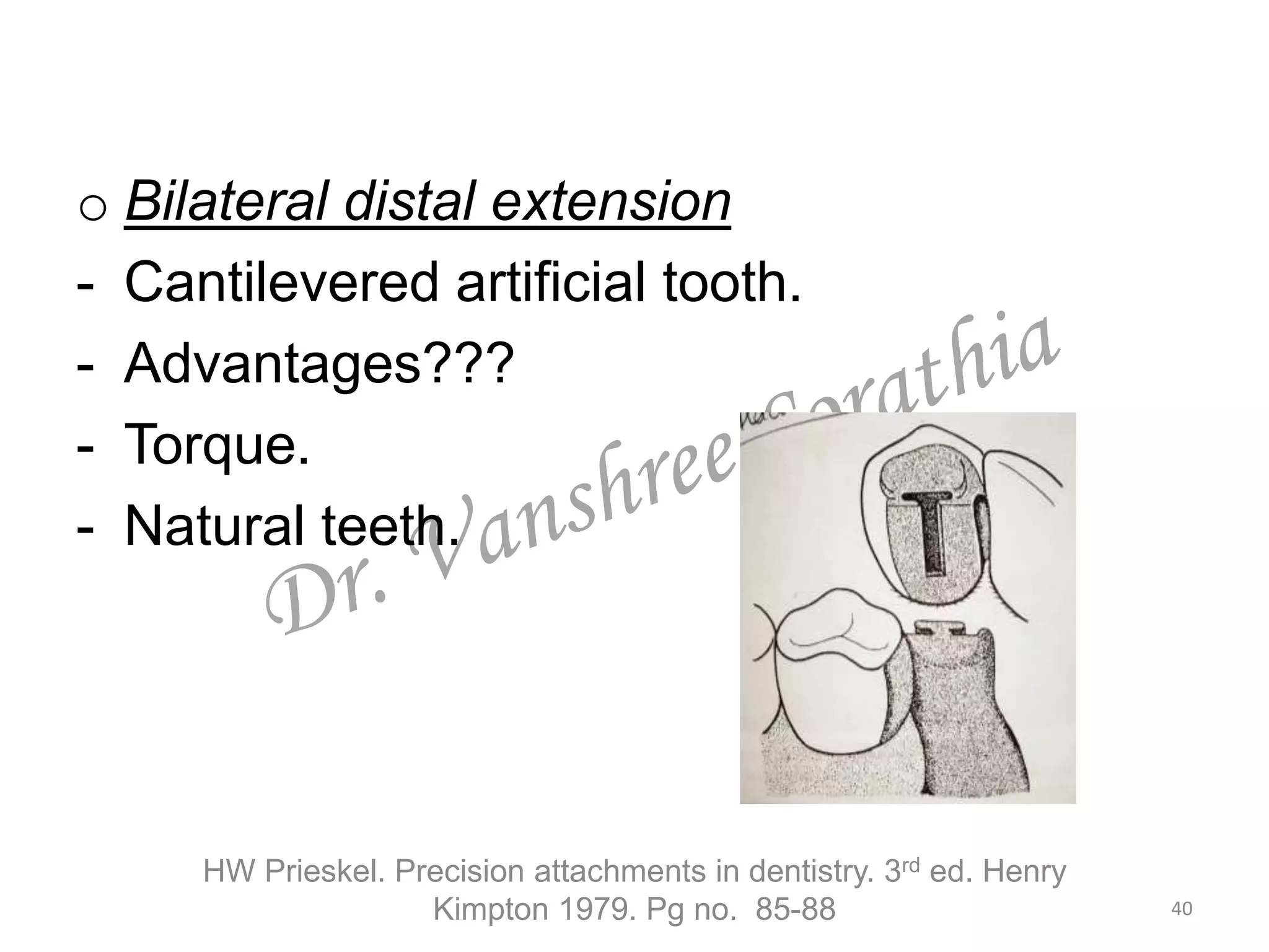 Intracoronal Attachments | PPTX