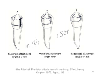 Intracoronal Attachments | PPTX