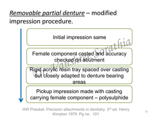 Intracoronal Attachments | PPTX