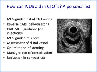 Intracoronary Imaging – when to use, how to use and how to interpret ...