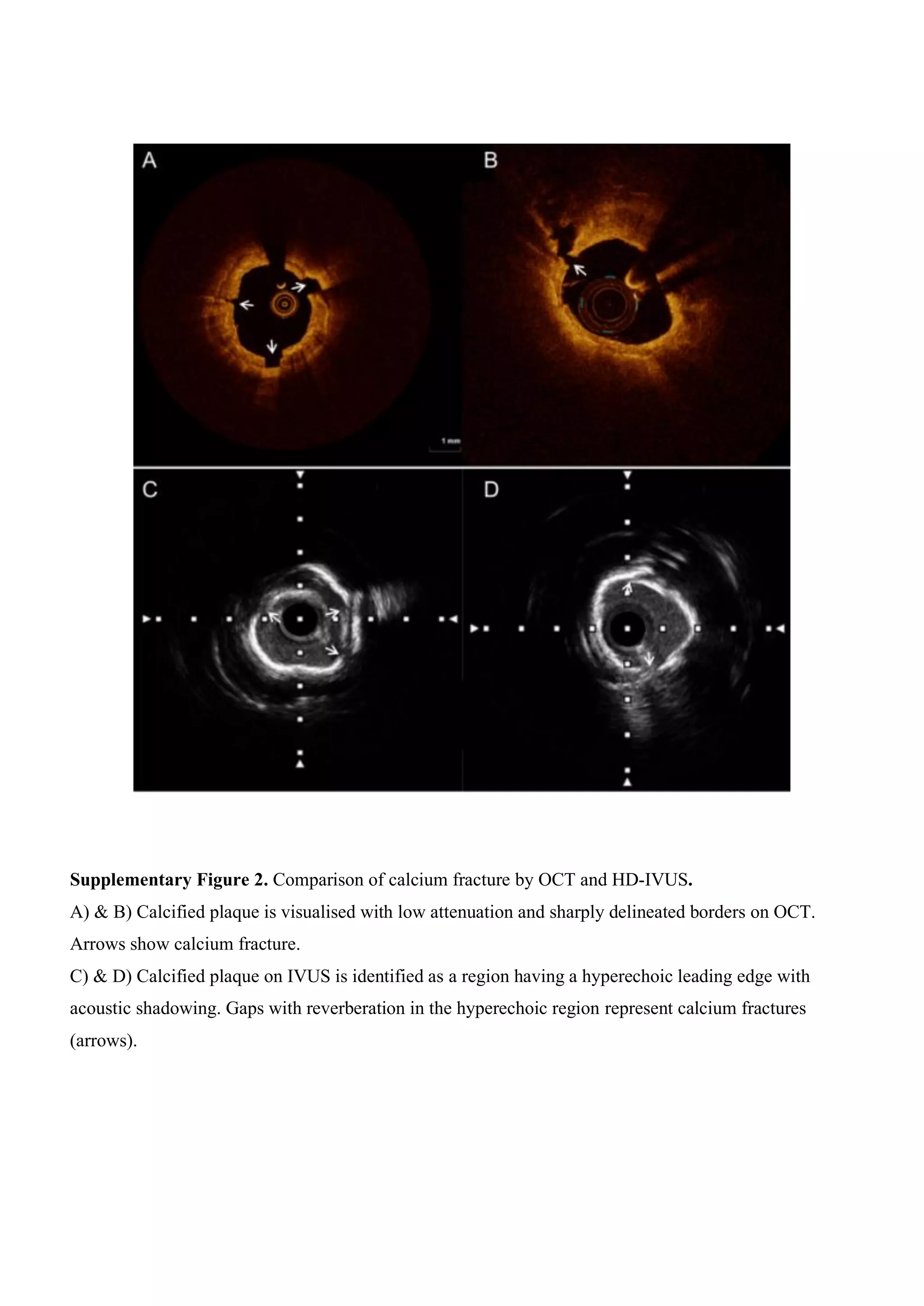 Intracoronary optical coherence tomography | PDF