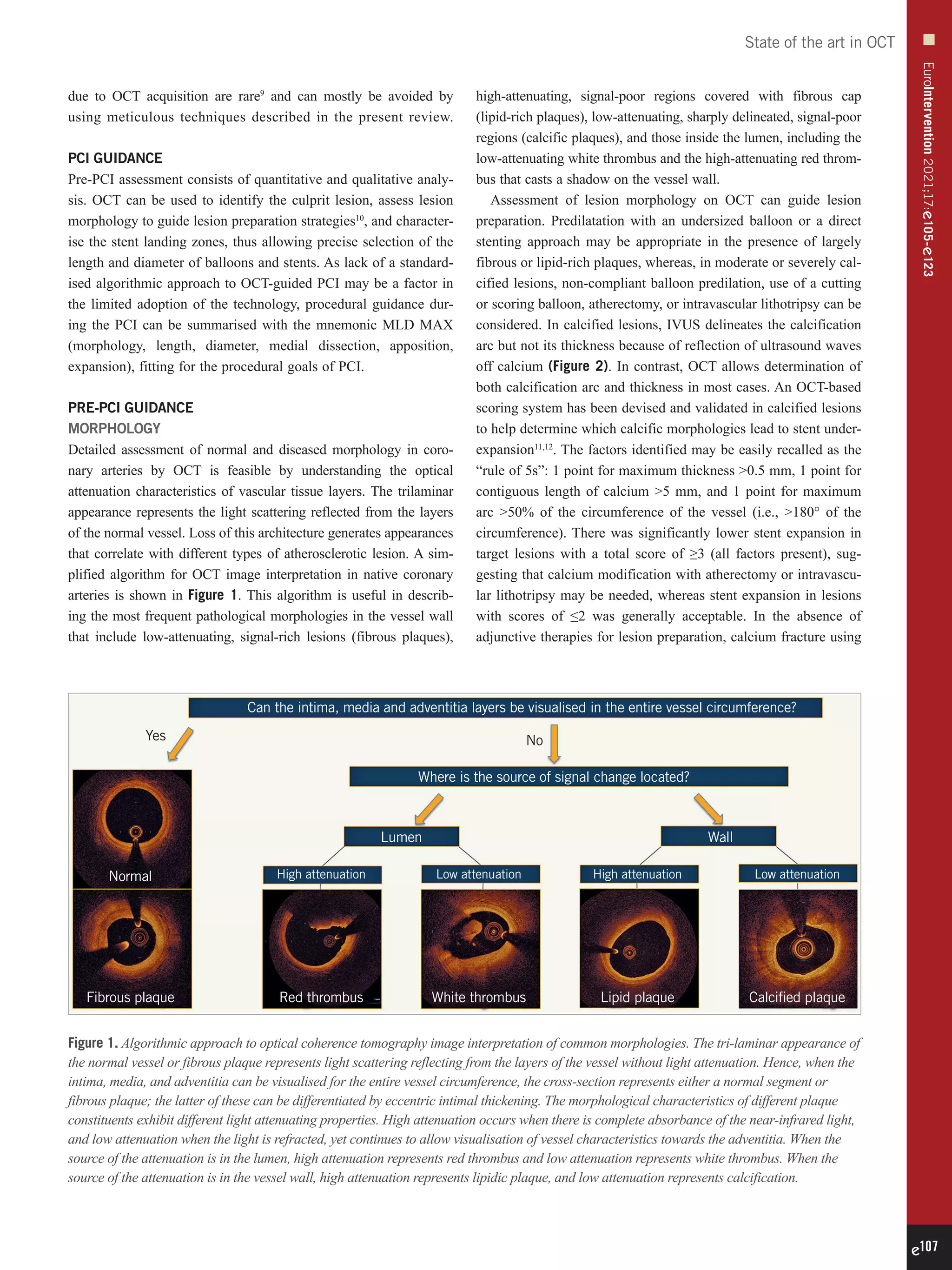 Intracoronary optical coherence tomography | PDF