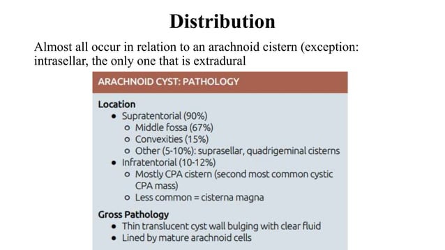 an review on Intracranial arachnoid cyst | PPT
