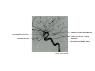 Internal Carotid Artery and Normal Variants | PPT