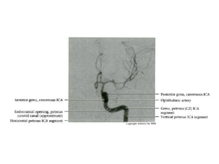 Internal Carotid Artery and Normal Variants | PPT