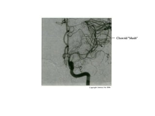 Internal Carotid Artery and Normal Variants | PPT