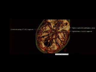 Internal Carotid Artery and Normal Variants | PPT
