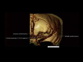 Internal Carotid Artery and Normal Variants | PPT