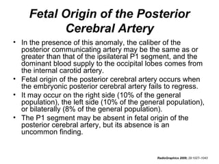 Internal Carotid Artery and Normal Variants | PPT