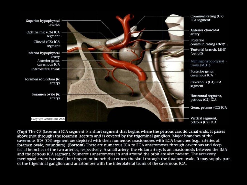 Internal Carotid Artery