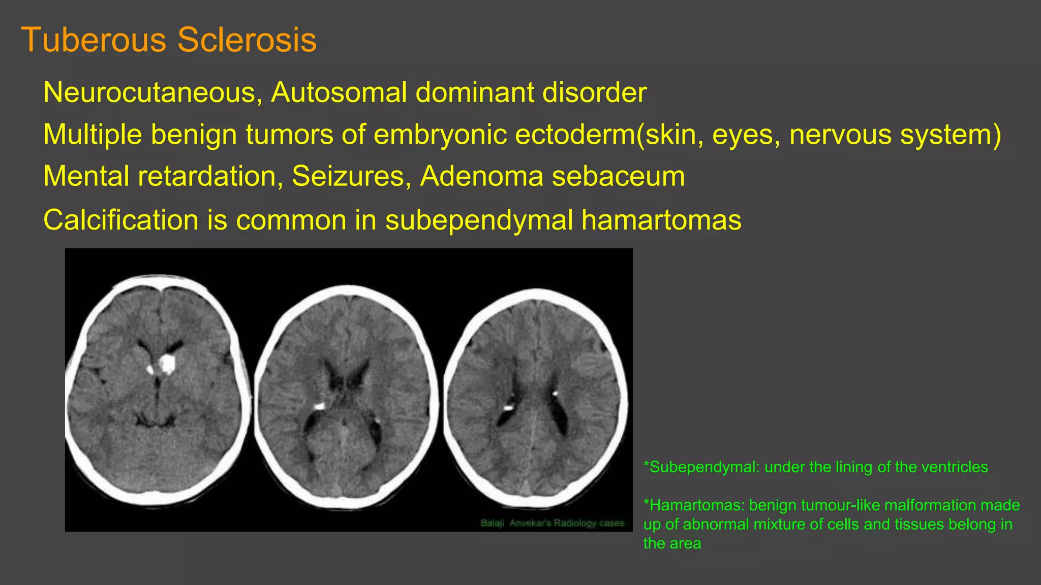 Intracranial Calcification in Cone Beam CT & Medical CT | PPTX
