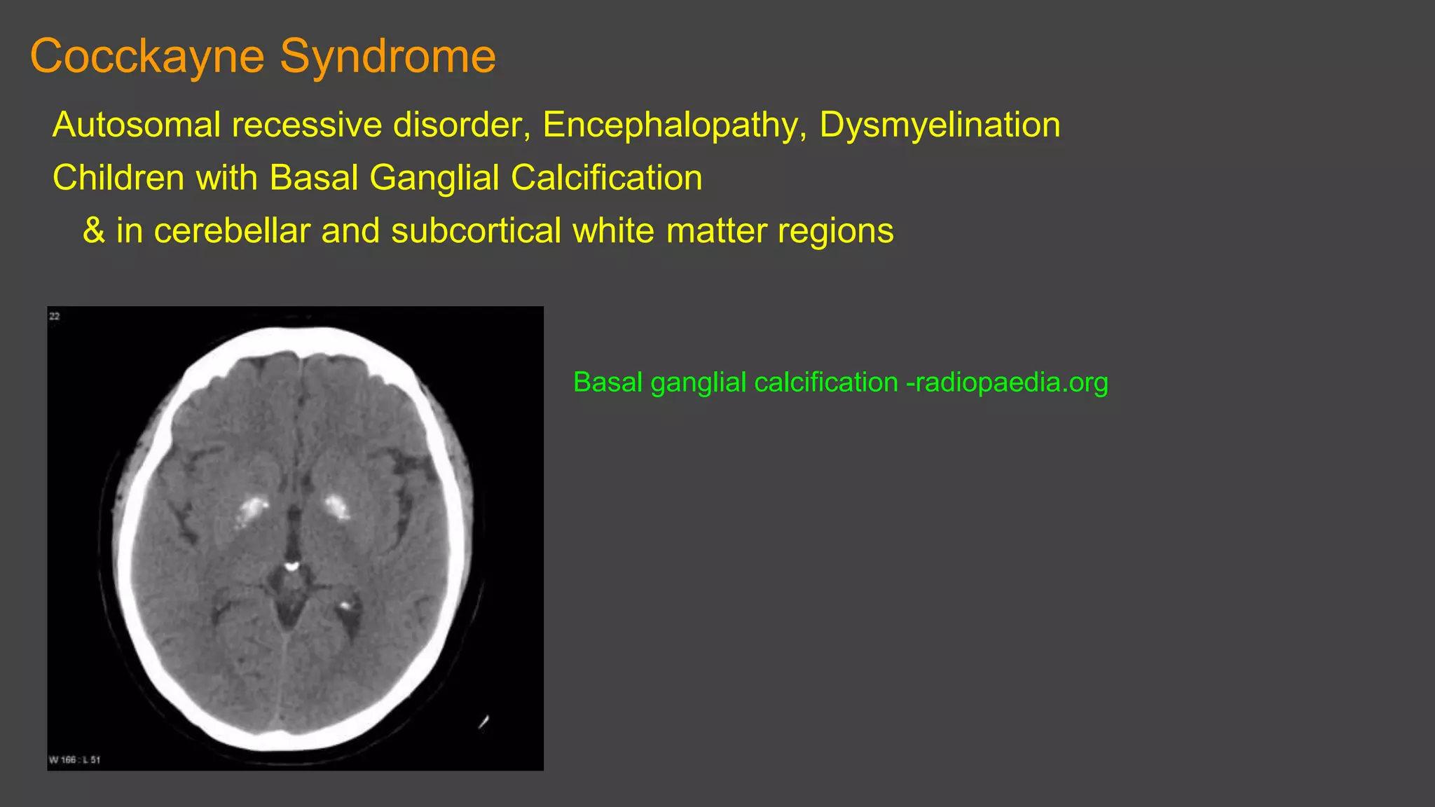 Intracranial Calcification in Cone Beam CT & Medical CT | PPTX