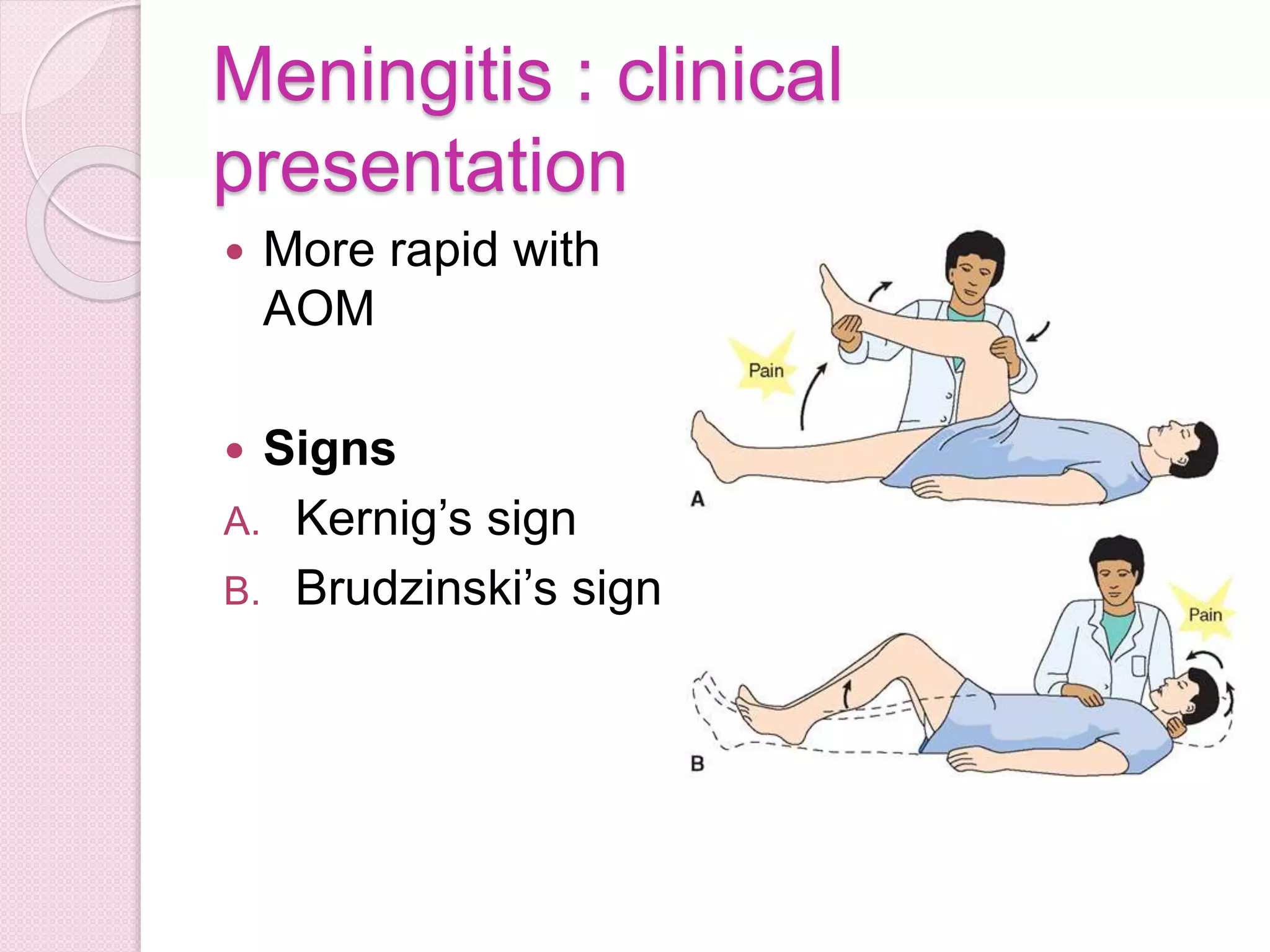Intracranial complications of chronic otitis media | PPTX