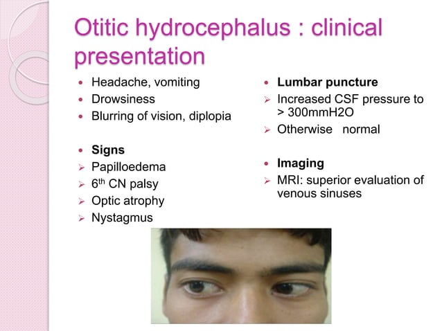 Intracranial complications of chronic otitis media | PPTX | Ear, Nose and Throat Conditions ...