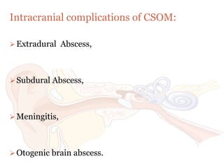 Intracranial complications of csom | PPTX