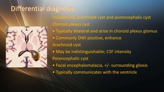 IMAGING OF INTRACRANIAL PRIMARY NON-NEOPLASTIC CYSTS | PPTX