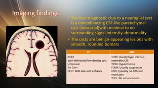 IMAGING OF INTRACRANIAL PRIMARY NON-NEOPLASTIC CYSTS | PPTX