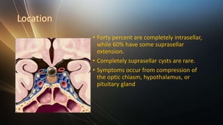 IMAGING OF INTRACRANIAL PRIMARY NON-NEOPLASTIC CYSTS | PPTX