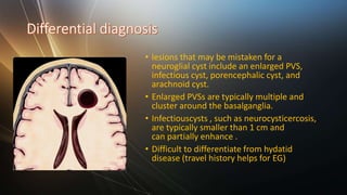 Porencephalic Cyst Mri