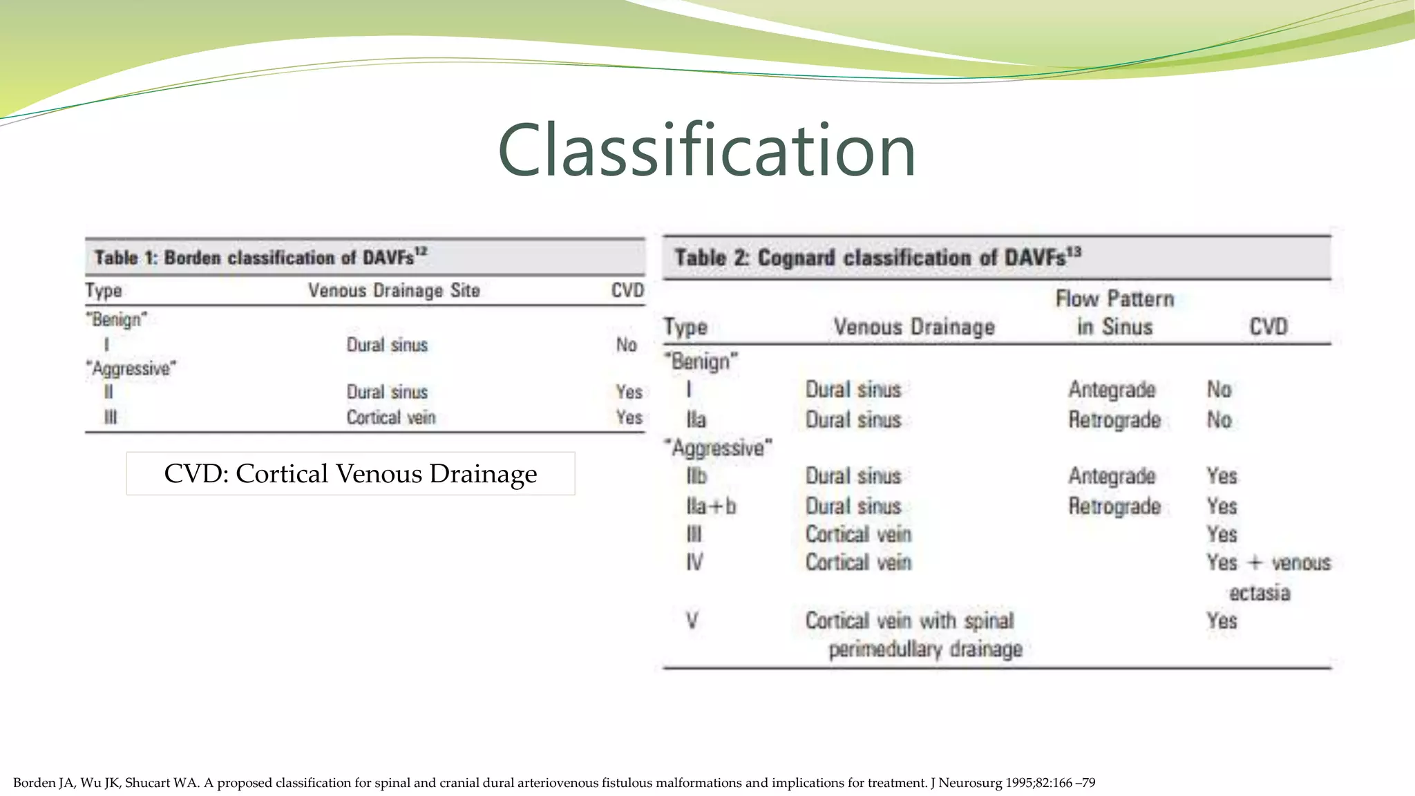 Intracranial Dural Arteriovenous Fistulas | PPTX