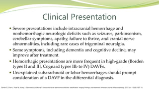 Intracranial Dural Arteriovenous Fistulas | PPT