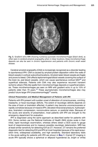 Intracranial hemorrhage. neurol clin | PDF